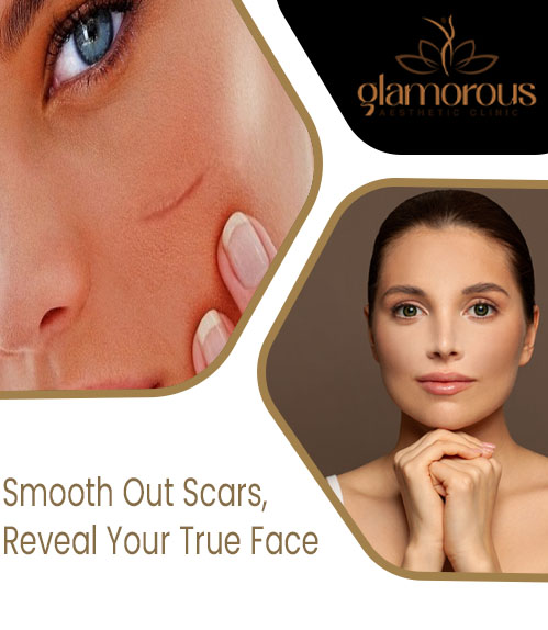 Facial Scar Revision in Islamabad Pakistan | Glam Aesthetics Clinic